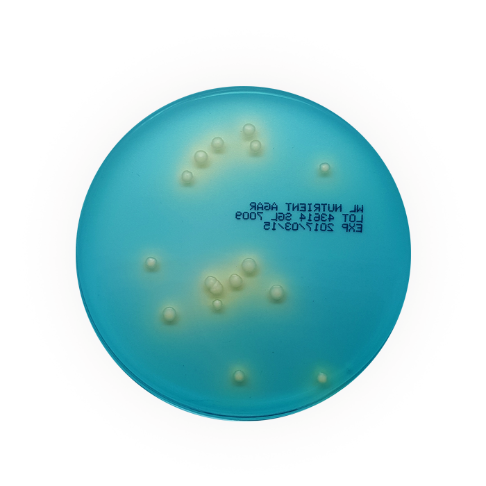 WL Nutrient Agar (WLN), 90mm Plate - Southern Group Laboratory