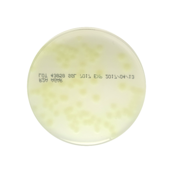 R2A Agar (Reasoner's 2A agar), 90mm Plate - Southern Group Laboratory
