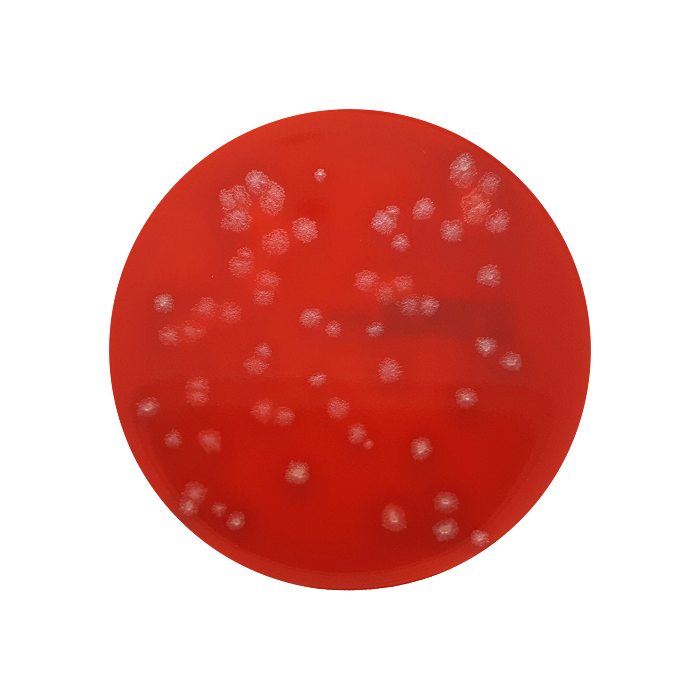 Columbia Blood Agar + 0.5% Yeast Extract + 5% Defibrinated Horse Blood ...