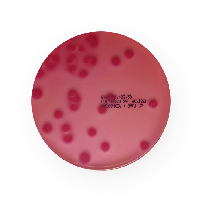 Enterococcus Faecalis Macconkey Agar