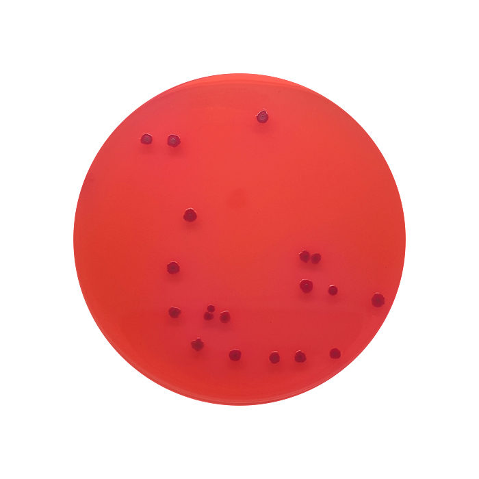 Yersinia Selective Enrichement Agar + Cefsulodin, Irgasan & Novobiocin ...