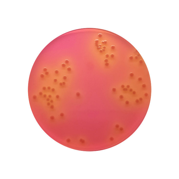Sorbitol MacConkey Agar, 90mm Plate - Southern Group Laboratory