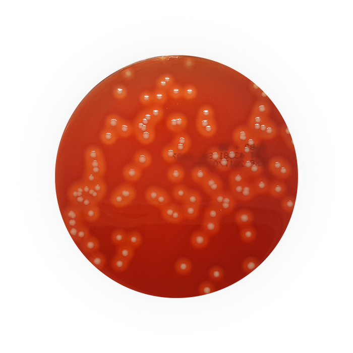 Columbia Blood Agar + 5% Defibrinated Horse Blood, 140mm Plate ...