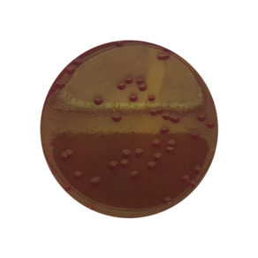 M – Endo Agar, 55mm Plate - Southern Group Laboratory