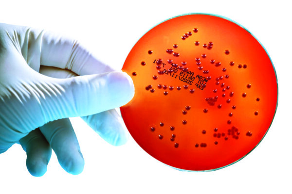 Burkholderia cepacia Feature - Southern Group Laboratory